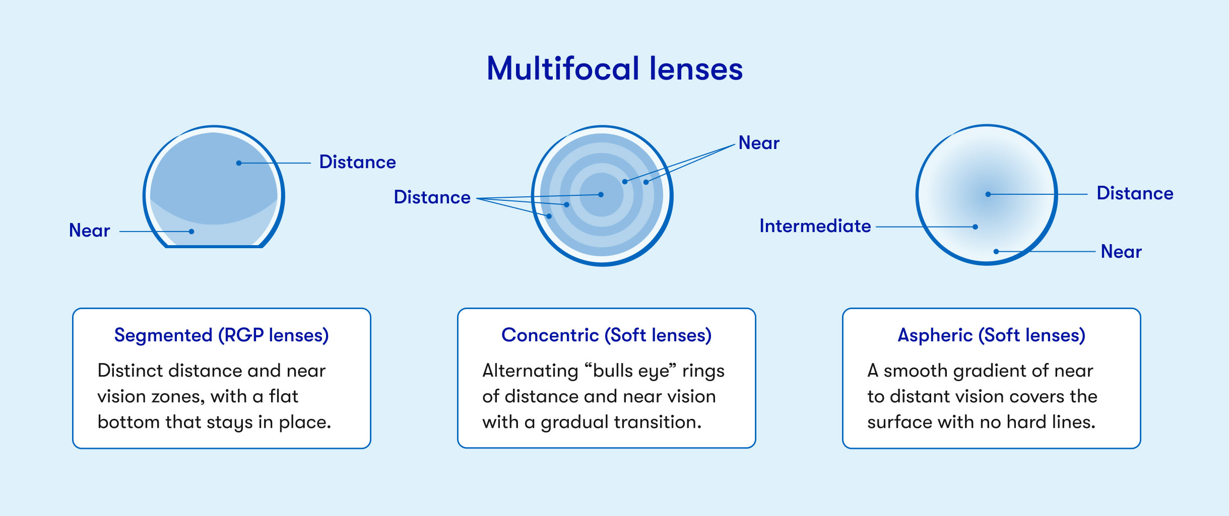 What Are Multifocal Contact Lenses? | 1-800 Contacts