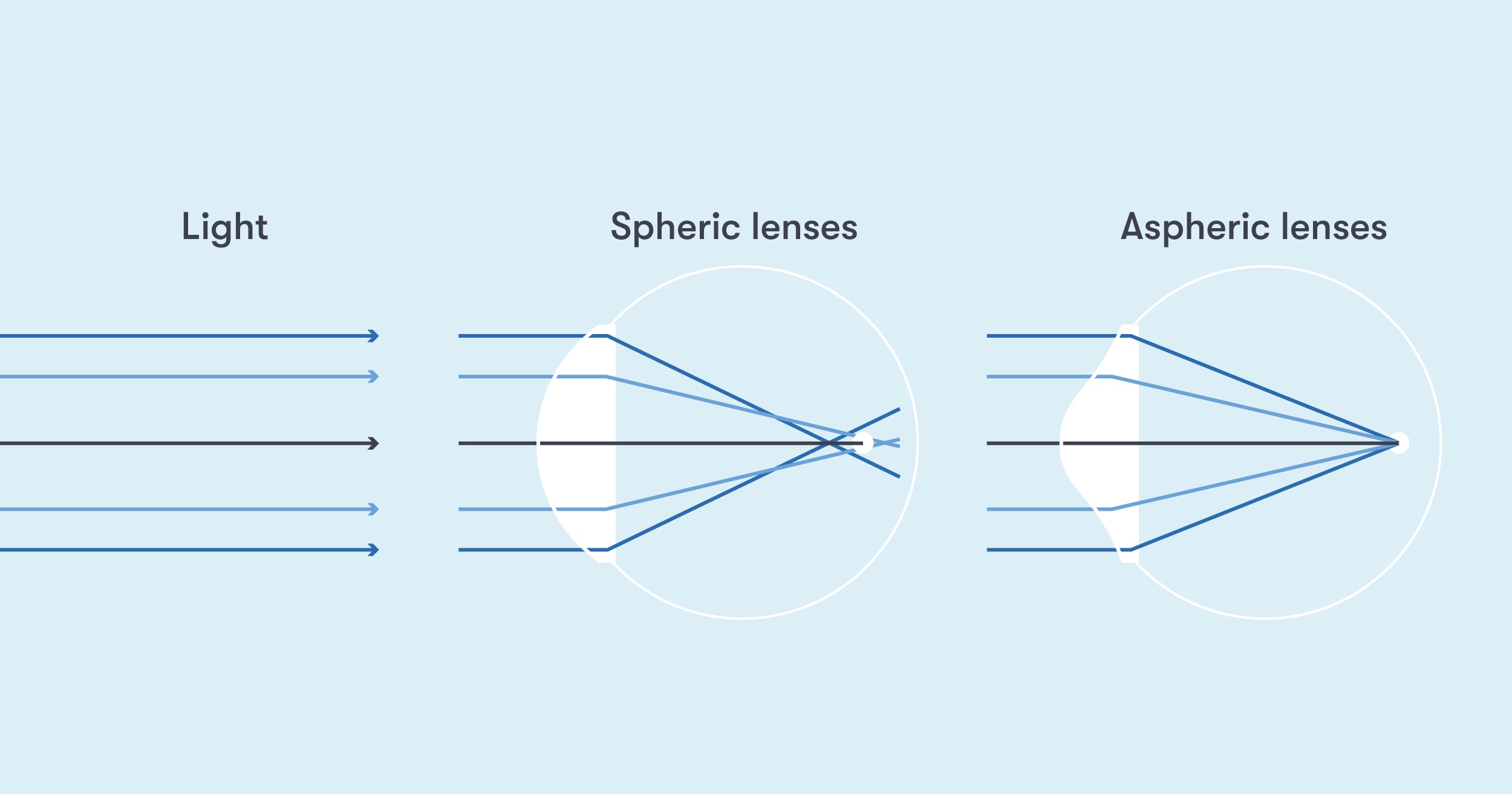Are Spherical Contact Lenses Right for You? | 1-800 Contacts