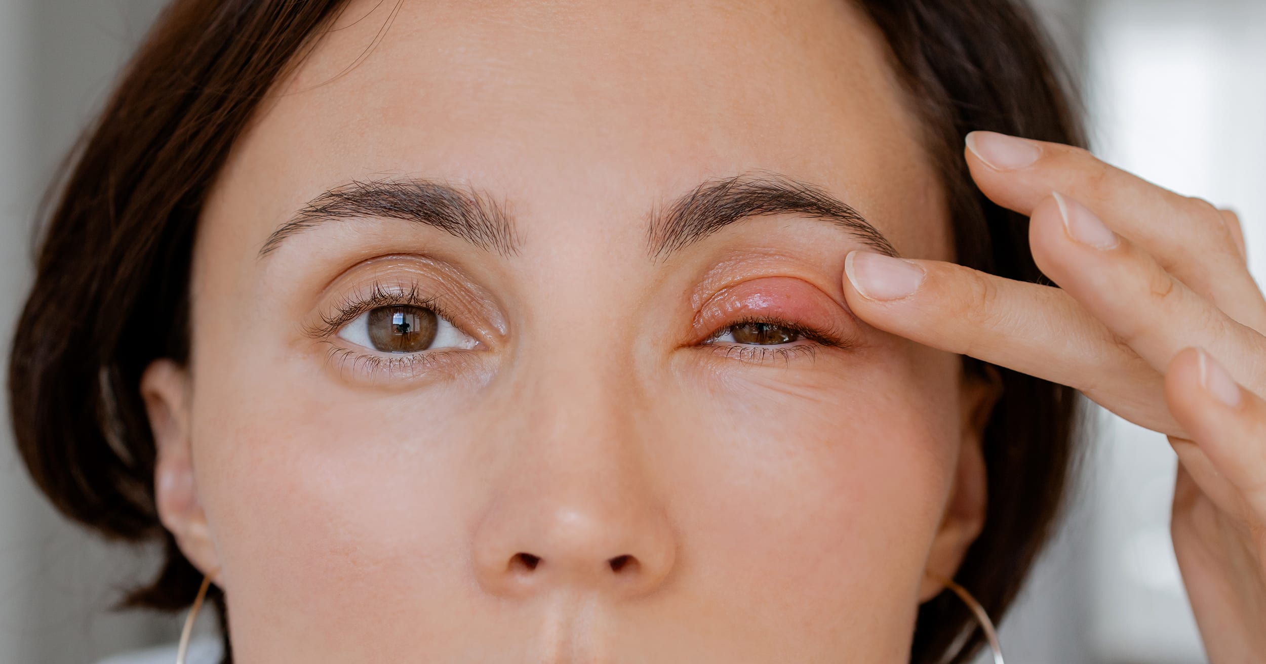 How to Get Rid of a Stye Overnight | 1-800 Contacts