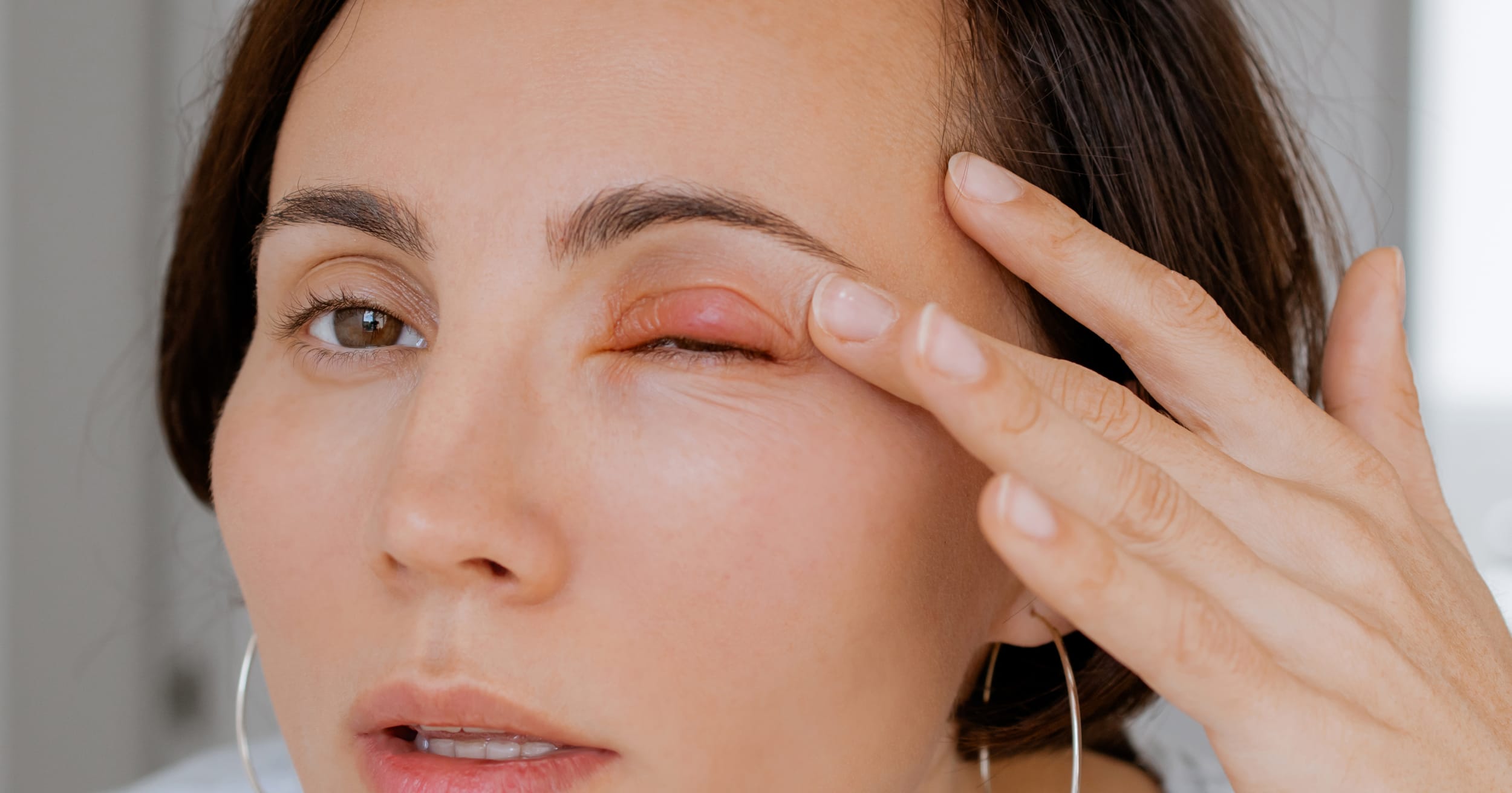 Can You Wear Contacts with a Stye? | 1-800 Contacts
