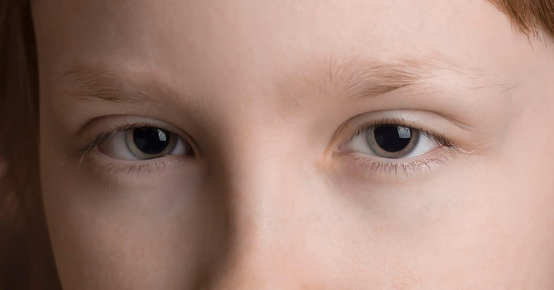 Eye Dilation | Eye Society | 1-800 Contacts