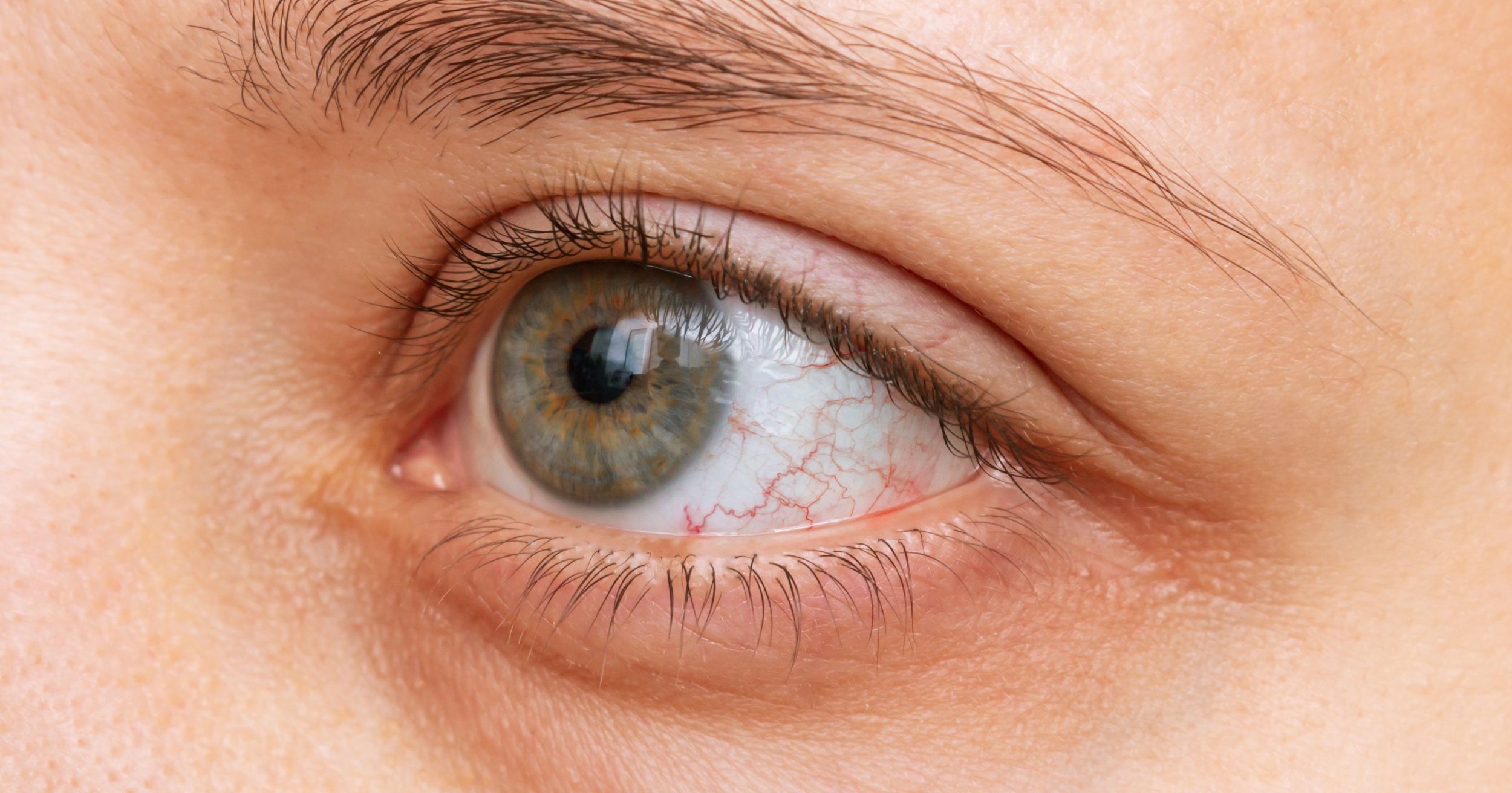 Blood Vessels Visible in Eyes | 1-800 Contacts